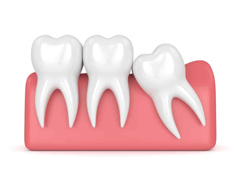 Types of Tooth: दांत के प्रकार और इनकी देखभाल से जुड़े नियम - हैलो ...