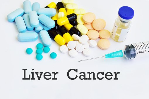 Chemotherapy treatment for Liver cancer: लिवर कैंसर के लिए कीमोथेरिपी ...